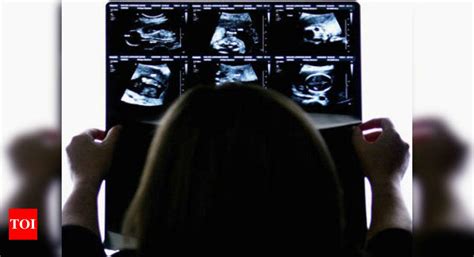 Sex Test B Scan Machine Under Radar Times Of India