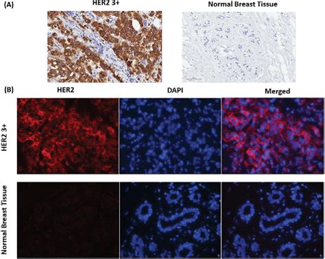 Figure 1 From Isers Microscopy Guided By Wide Field Immunofluorescence