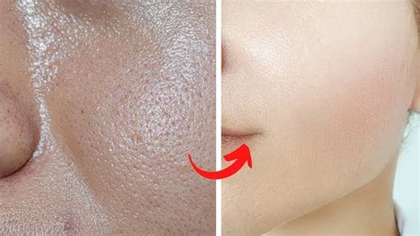 Shrink Enlarged Open Skin Pores Diy Face Wash For Glowing Skin