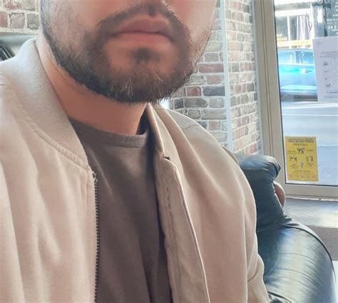 탈모가 왔다 머리를 밀었다 패션 에펨코리아