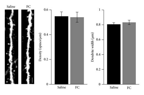 Astrocytic Activity Is Necessary For Motor Skill Learning A Motor Download Scientific