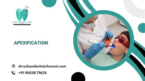 Apexification 4 Powerful Benefits For Tooth Root Health