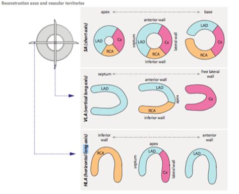 Nucs Cardiac Flashcards Quizlet