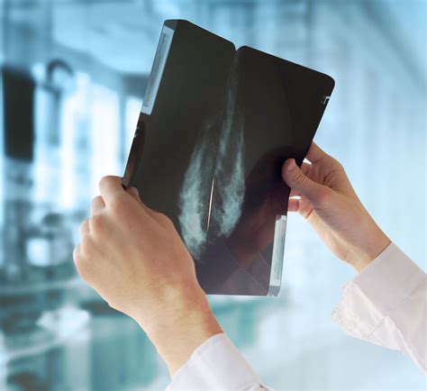 Mammography Radiology Group Of Abington