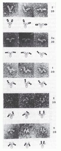 Immunoglobulins Structure And Function Oncohema Key