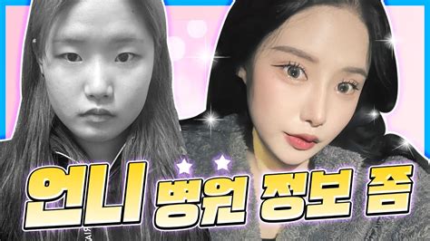 눈코안면윤곽 예쁘면 언니지 병원 정보 좀 주세요💖 1달차 비포 애프터 리얼후기 버블tv Youtube