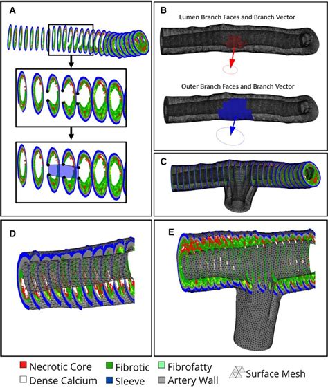 Frontiers Automated Finite Element Approach To Generate Anatomical Patient Specific