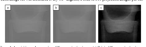 Figure 1 From Quantum Optimization Algorithms For Ct Image Segmentation