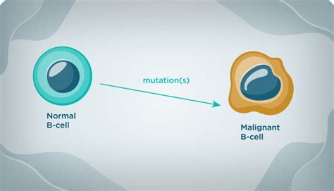 What Is Chronic Lymphocytic Leukemia Small Lymphocytic Lymphoma
