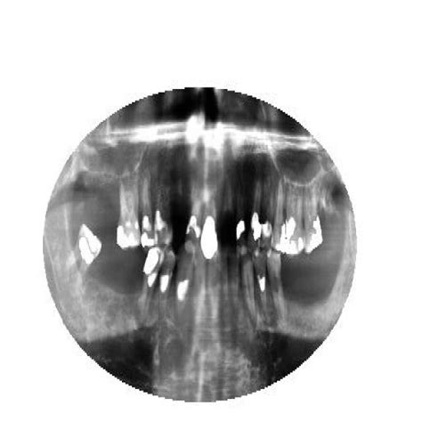 Dental X Ray Object Detection Dataset V1 2024 03 13 1 56pm By Gozdes Projects