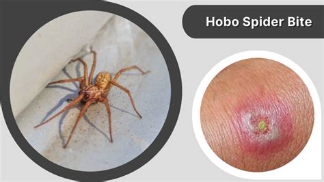 33 Types Of Spider Bites Identification Danger Levels And Pictures