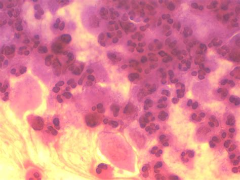 As Glasgow Science Centre Hosts Show About Sexual Diseases Can You Identify The STIs From These