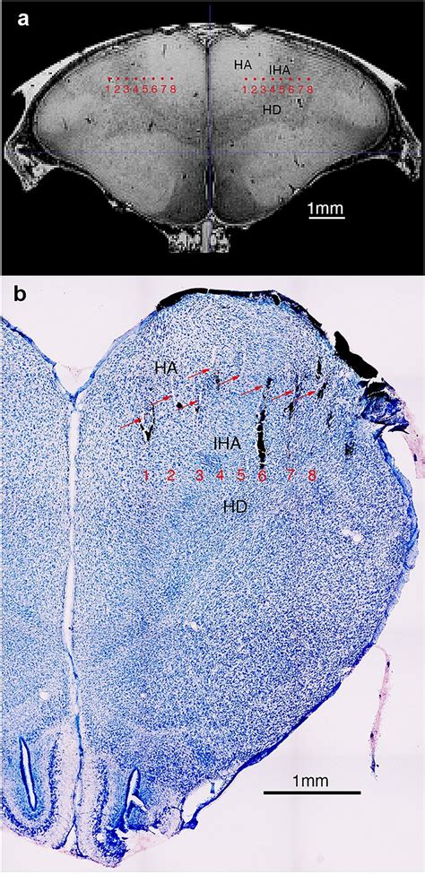 Visualisation Of The Electrode Array Placement A Schematic