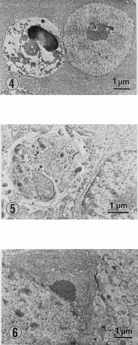 An Electron Micrograph Of The Pancreas From A Newborn Gerbil Large Download Scientific Diagram