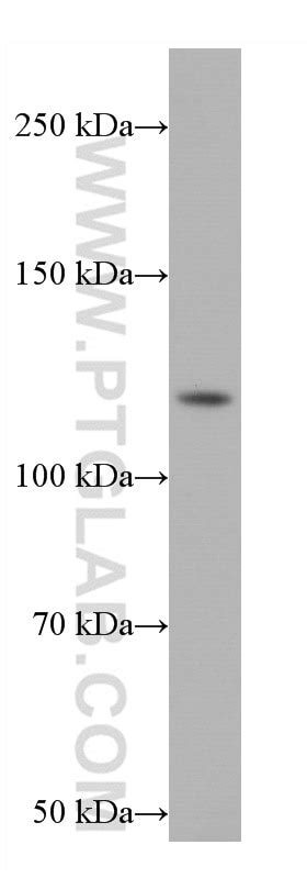 Integrin Alpha 6 Fusion Protein Ag25835 Proteintech