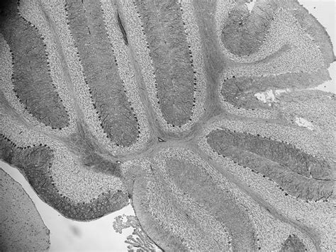 Why Do I Observe Uneven Staining Patterns With Calbindin Antibody On