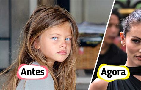 A “menina Mais Bonita Do Mundo” Cresceu E O Novo Visual Está Dando O