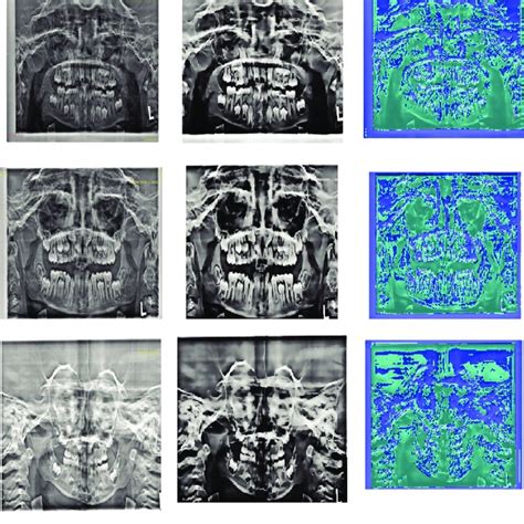 Segmented Image Dcnn Download Scientific Diagram