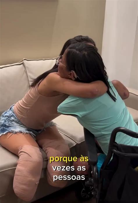 Quad Amputee Friends Thisvid Com