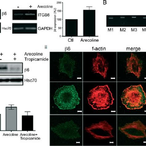 Immunohistochemistry Showing Representative α V β 6 Expression In Download Scientific Diagram