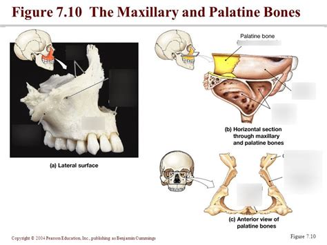 Maxillae And Palatine Bones Diagram Quizlet