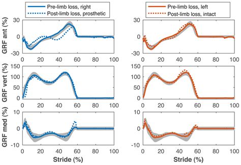 Transfemoral Limb Loss Modestly Increases The Metabolic Cost Of Optimal Control Simulations Of
