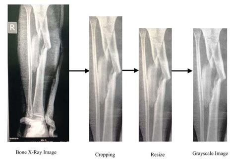 Process Of Image Pre Processing 3 Feature Extraction Using Glcm In Download Scientific Diagram