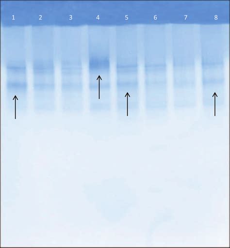 Native Gel 10Ð20 Of Soybean Leaf Protein Extract Stained For