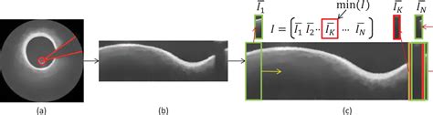 Figure 1 From Automatic Image Classification In Intravascular Optical Coherence Tomography