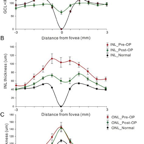Segmentation Profiles Of Intraretinal Layers In Normal Eyes And Erm