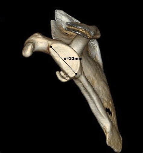 A Case Example Is Presented To Illustrate How The Gender Specific CT Download Scientific
