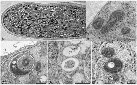 Autophagy And Its Mediated Mitochondrial Quality Control Maintain