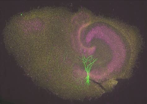 Interdisciplinary Institute For Neuroscience On Linkedin