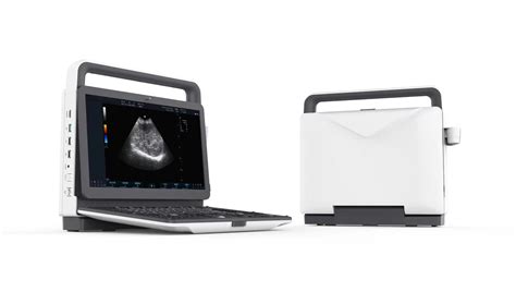 Medical Equipment Full Digital Portable Mobile Echocardiography Cardiac Echo Ultrasound Scan