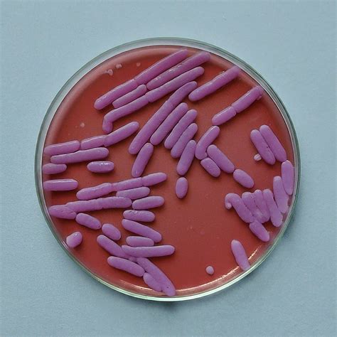Infection Causing Super Bacteria Pseudomonas Aeruginosa