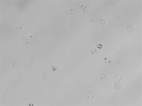 Video Microcrystallography Of Protein Crystals And In Cellulo Diffraction