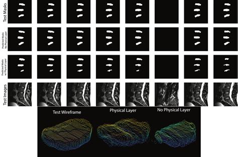 Automated Segmentation And 3d Surface Model Generation Of