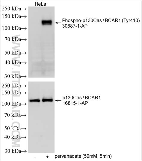 Phospho P130cas Bcar1 Tyr410 Antibody 30887 1 Ap Proteintech