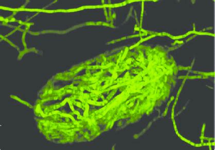 Egg Of A Nematode Parasited By Pochonia Chlamydospores Photograph By
