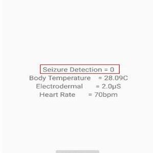 Detection Of Epilepsy Seizure Download Scientific Diagram