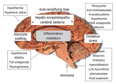 Hyperammonemia And Brain