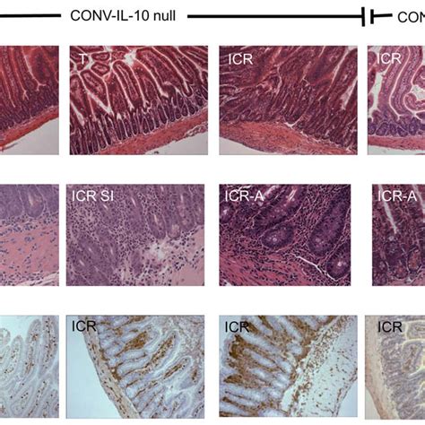 Schematic Diagram Of Ileocecal Resection Icr And Tissue Harvest