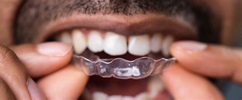 Caring For Your Teeth With Invisalign Brushing And Flossing Instructions