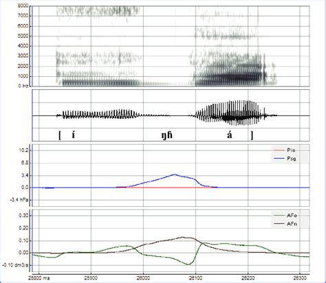 Spectrogram Audio Waveform Intraoral Pressure Po Oral Airflow