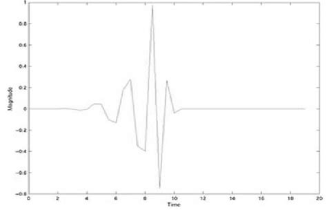 Figure 1 From Ecg Signal Denoising By Wavelet Transform Thresholding