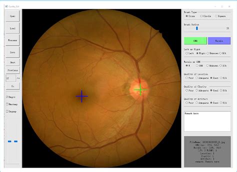 Figure 3 From Refined Image Quality Assessment For Color Fundus Photography Based On Deep