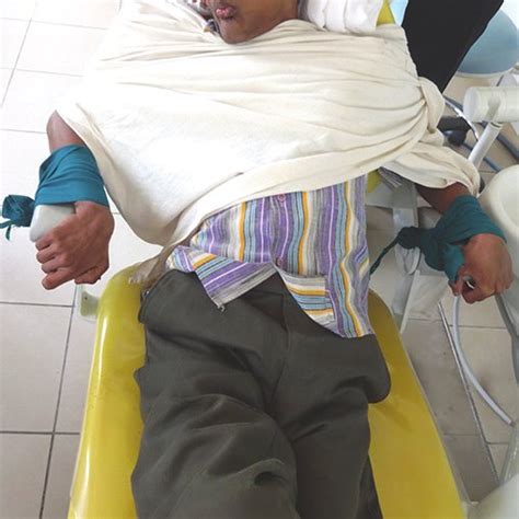 Bind M Score Versus Consultant Diagnosis Of Acute Bilirubin Download Table