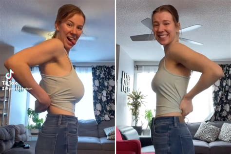 Teen Breast Reduction Before And After Post Surgery Weight Trends