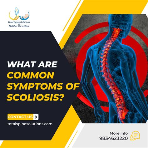 Symptoms Of Scoliosis Total Spine Solutions Clinic
