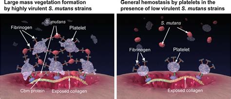 Streptococcus Mutans